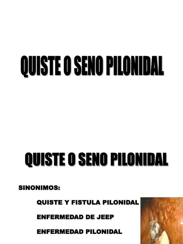 Tratamiento y manejo de la enfermedad pilonidal: quistes, abscesos y ...