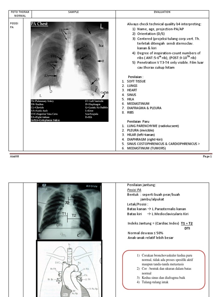 Evaluasi Foto Thorax Normal dan Abnormal | PDF