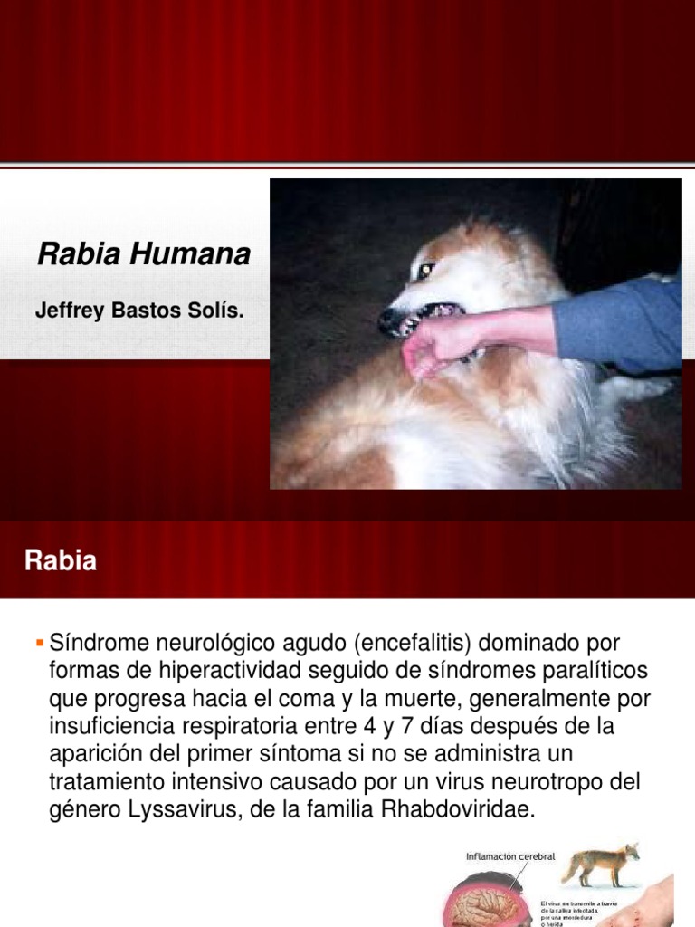 Rabia Humana | PDF | Rabia | Especialidades Medicas
