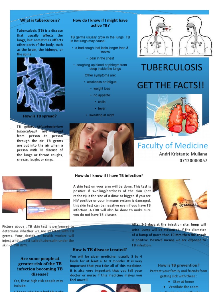 Brochure Tuberkulosis | PDF