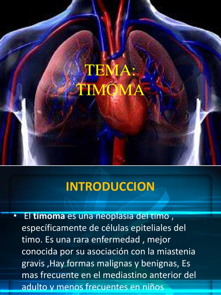 TIMOMA | PDF | Cáncer | Timo