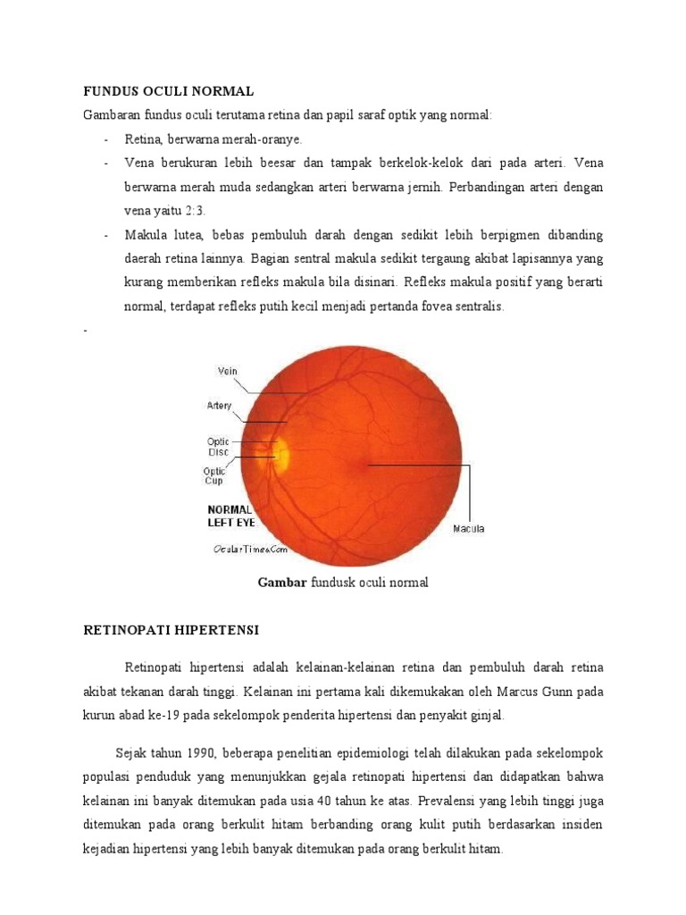 Retinopati HIPERTENSI | PDF