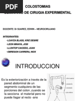 Sigmoidectomía Laparoscópica: Técnica y Equipo | PDF | Intestino grueso ...