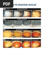 Escalas de Efron | PDF | Cornea | Contact Lens