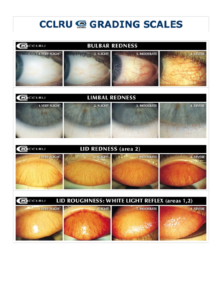 Cclru Grading Scale | PDF