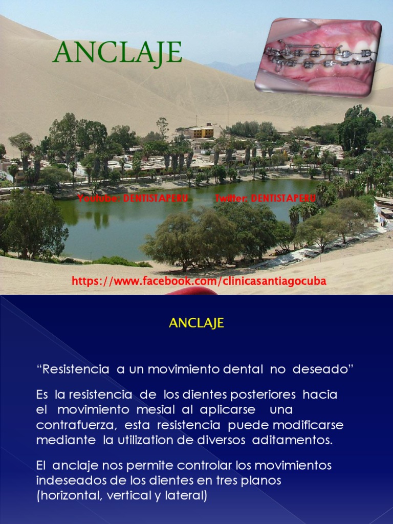 Atp y Boton de Nance | PDF | Ortodoncia | Movimiento (física)