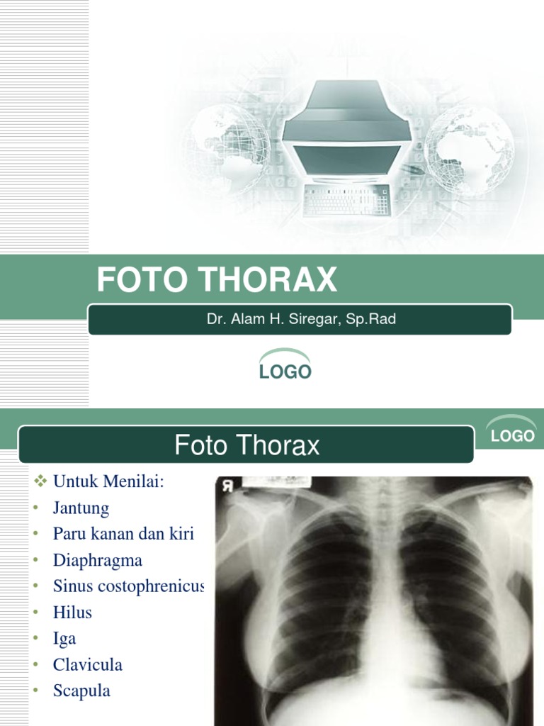 Foto Thorax | PDF