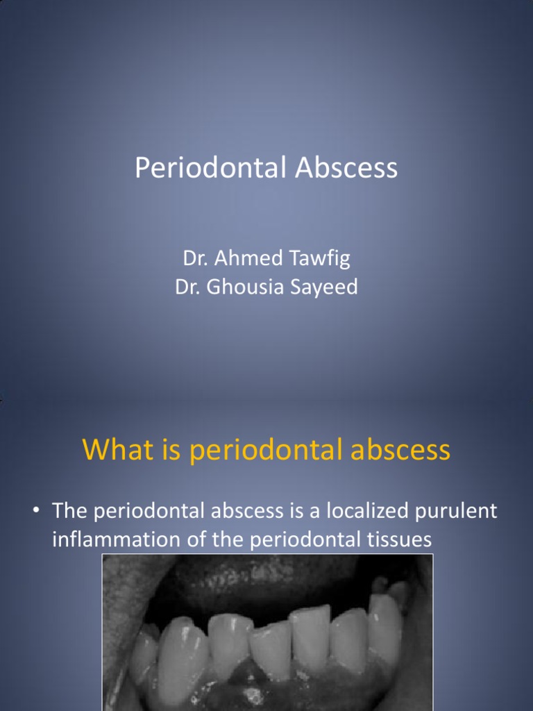 Periodontal Abscess | Mouth | Dentistry