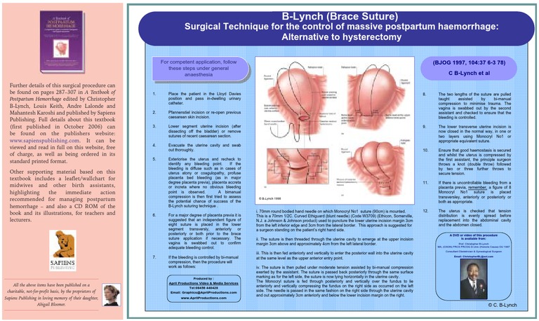 b-Lynch.pdf | Uterus | Surgical Suture