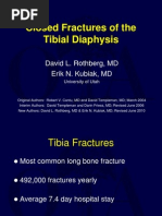 T2 Tibial Nailing System - Stryker | PDF | Anatomical Terms Of Motion ...