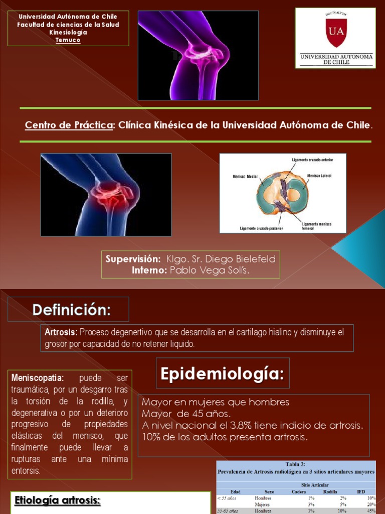 Presentacion de Meniscopatia y Artrosis | PDF | Rodilla | Osteoartritis