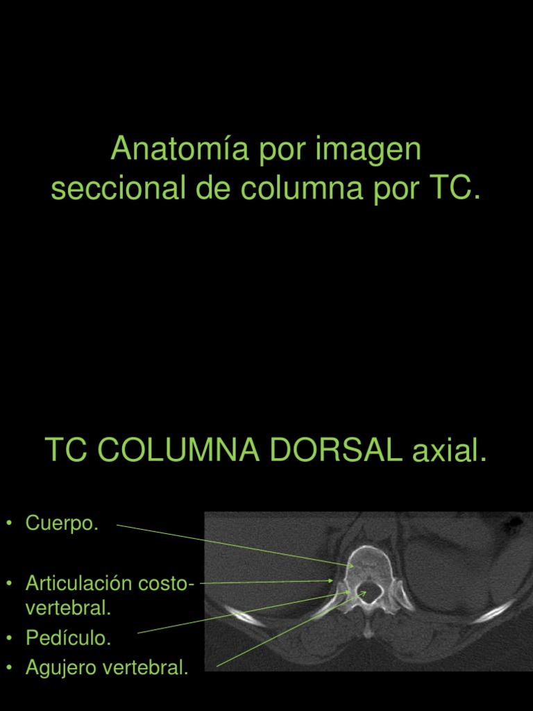 Anatomía Seccional de Columna por TC | PDF | Anatomia animal ...