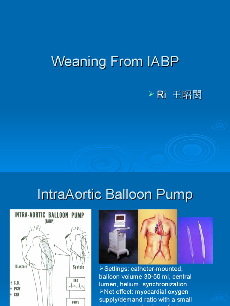 Weaning From IABP | Ischemia | Shock (Circulatory)