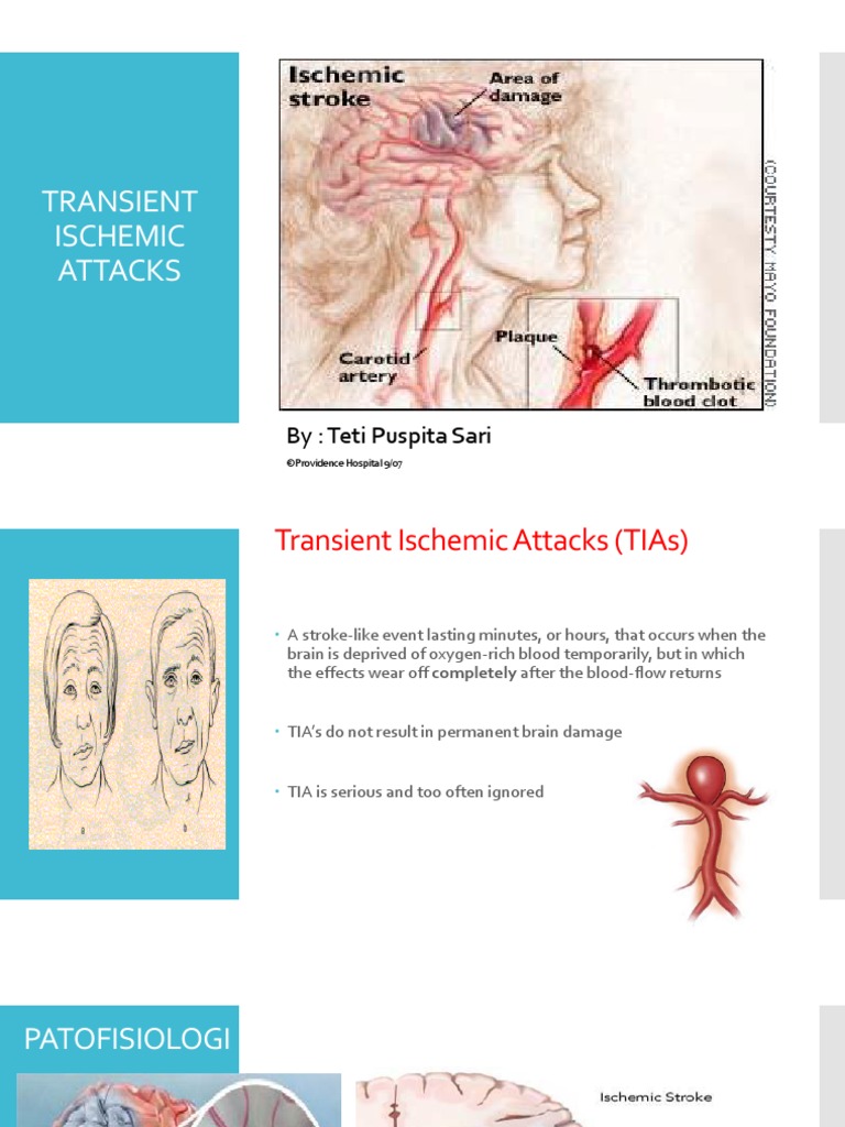 Transient Ischemic Attacks: By: Teti Puspita Sari | PDF