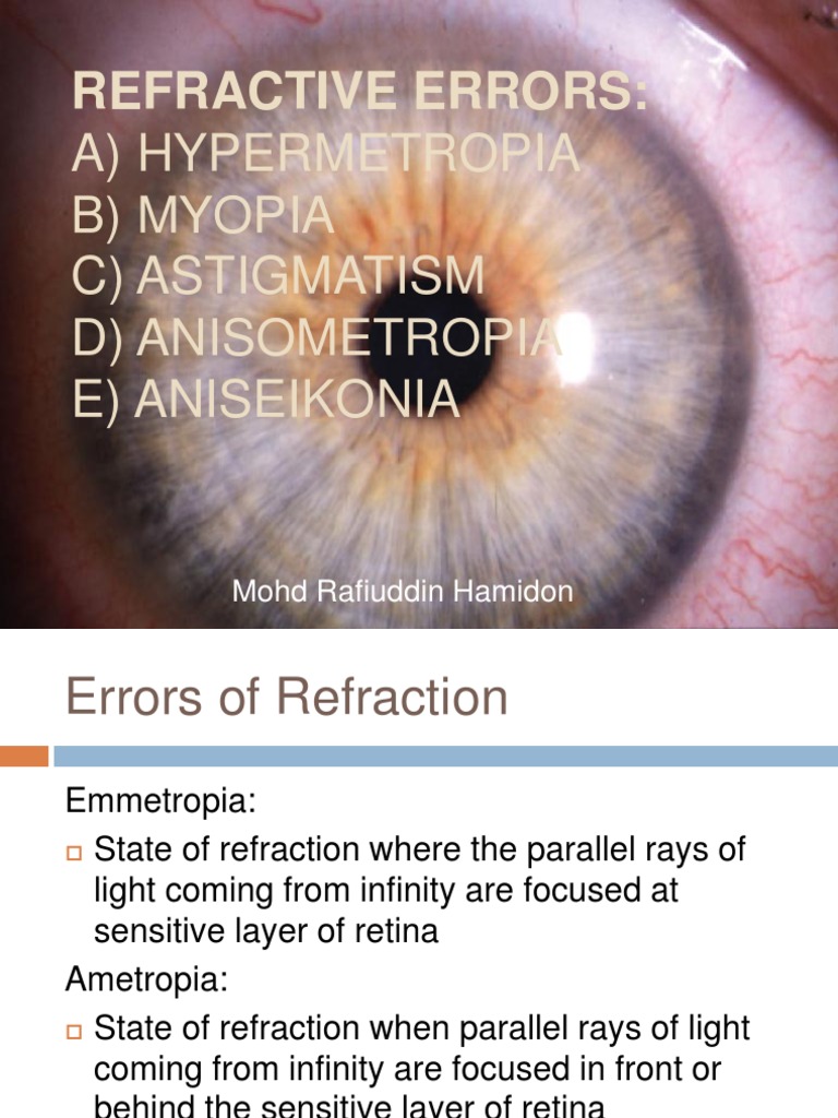 Understanding Refractive Errors of the Eye | PDF | Human Eye | Eye