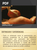 Onfalocele | PDF | Abdomen | Hospital