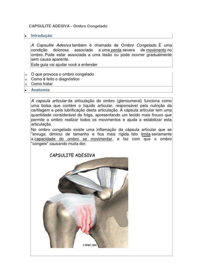 CAPSULITE ADESIVA | Medicina clínica | Especialidades Médicas