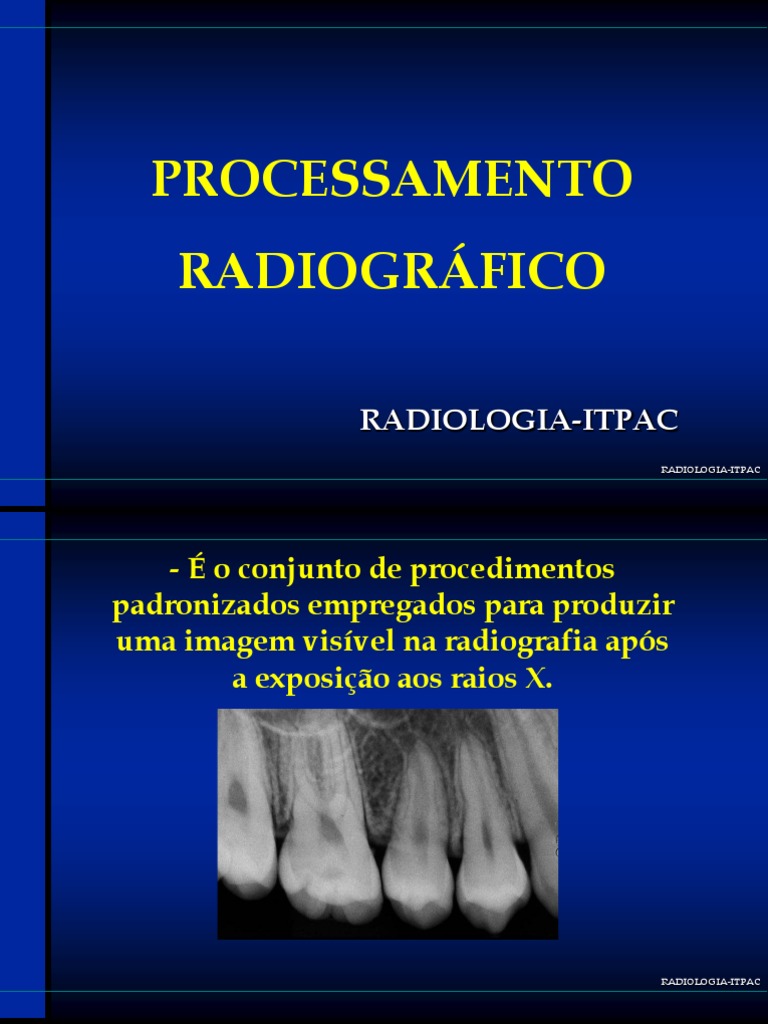 3-Processamento Radiografico | PDF | Física Aplicada e Interdisciplinar | Química