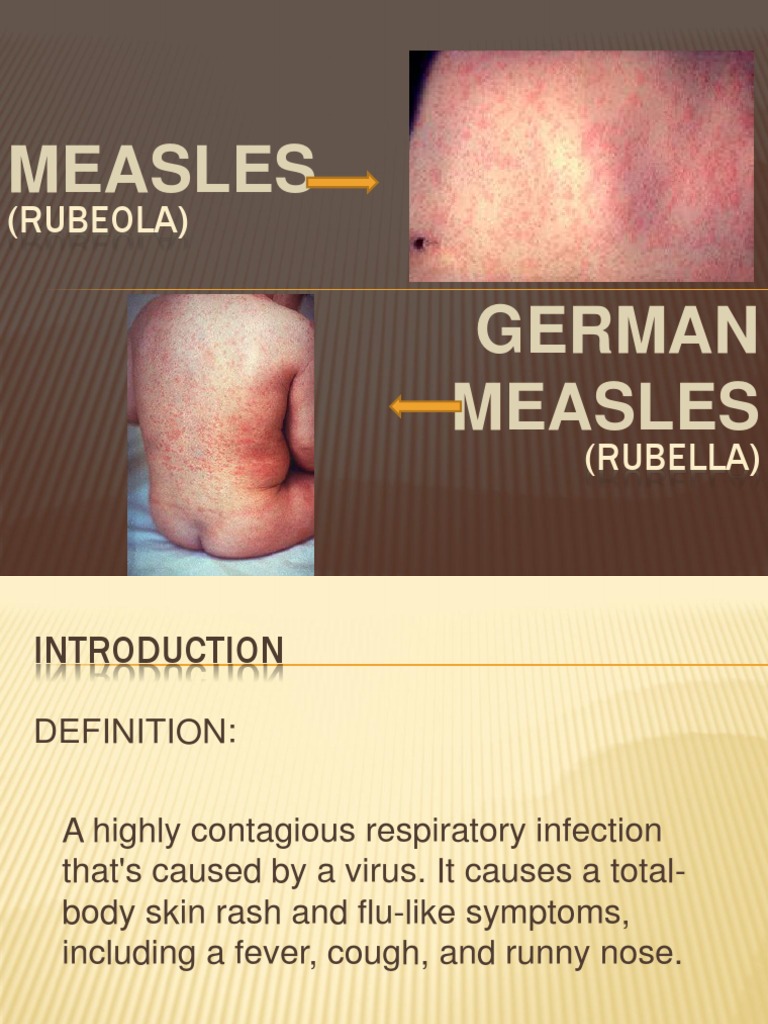 Rubeola Vs Rubella Rash