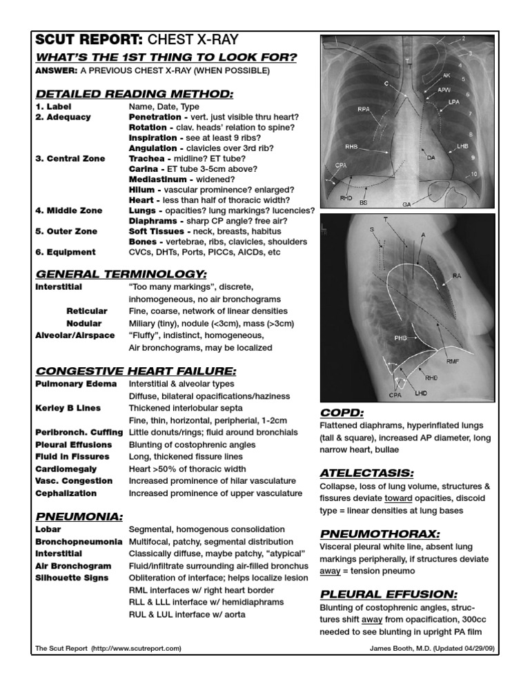 Scut Report: Chest X-Ray | PDF | Lung | Thorax Scut Report: Chest X-Ray | PDF | Lung | Thorax