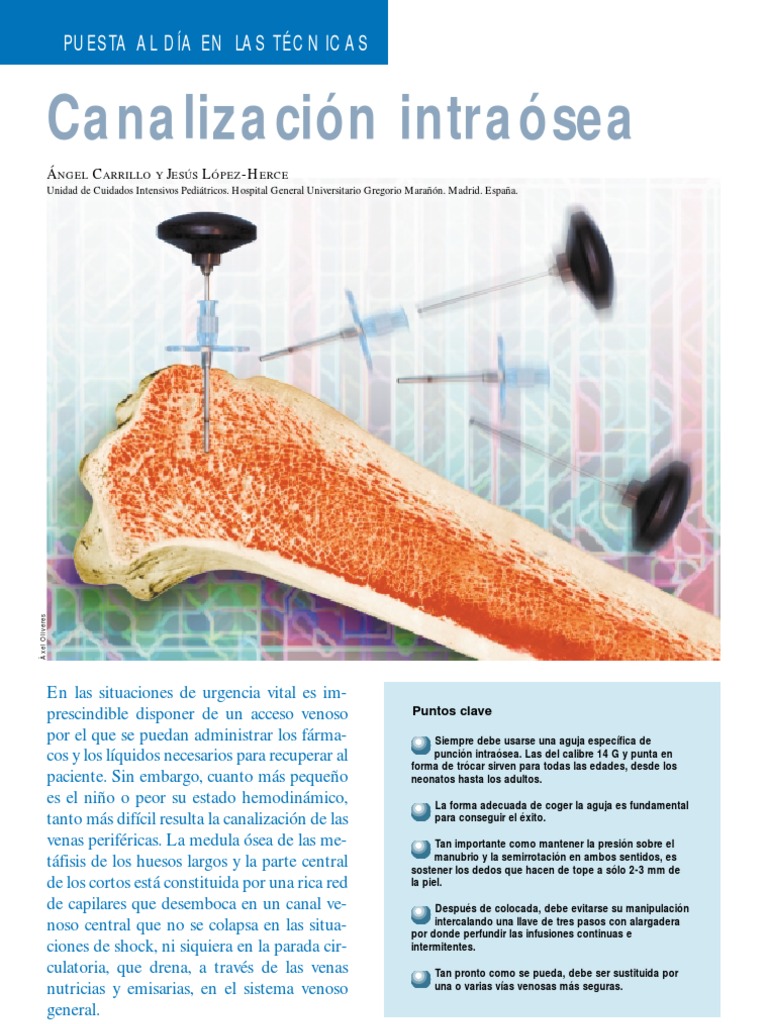 osteoclisis | Especialidades Medicas | Medicina CLINICA