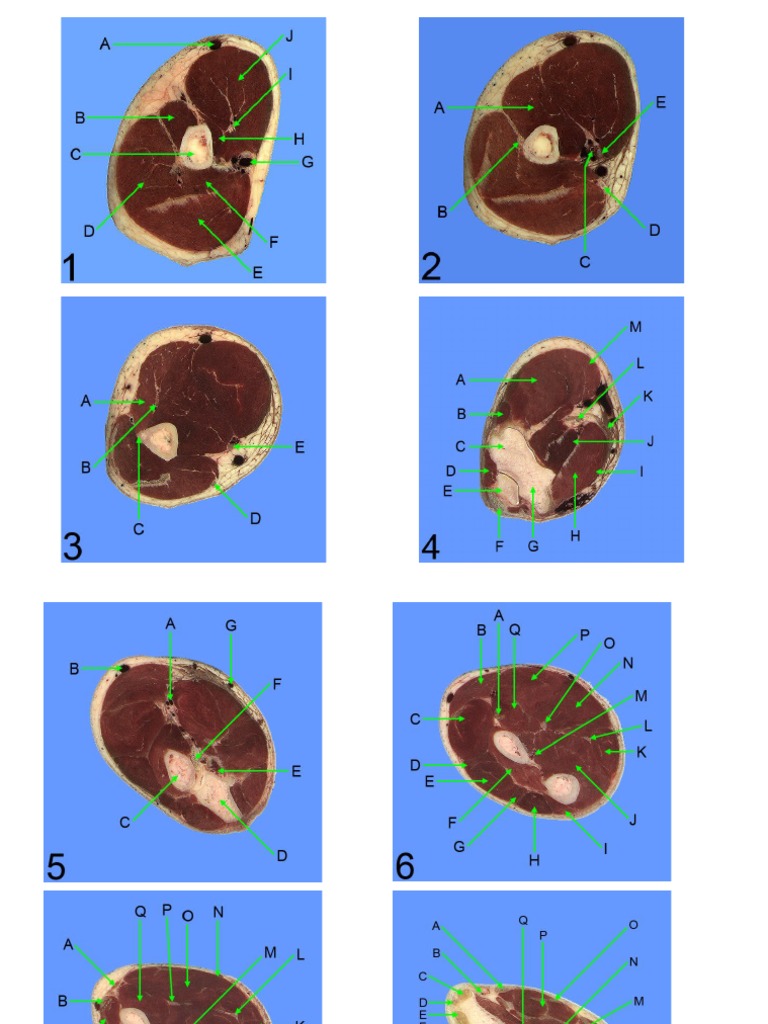 Cross Sections of Upper Limb | PDF | Arm | Human Anatomy