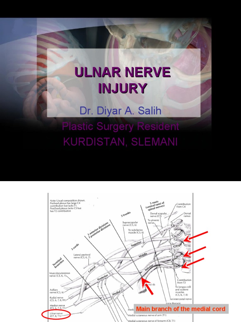Ulnar Nerve Reconstruction | PDF | Elbow | Limbs (Anatomy)
