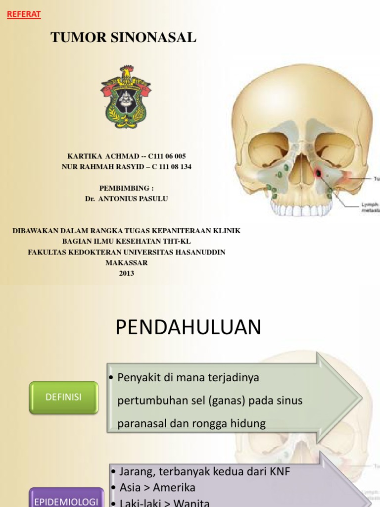 Tumor Sinonasal | PDF