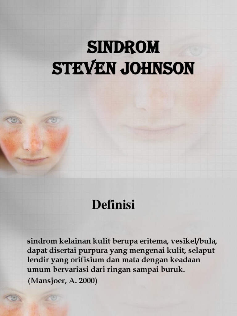 Sindrom Steven Johnson: Gejala & Etiologi | PDF | Sains & Matematika
