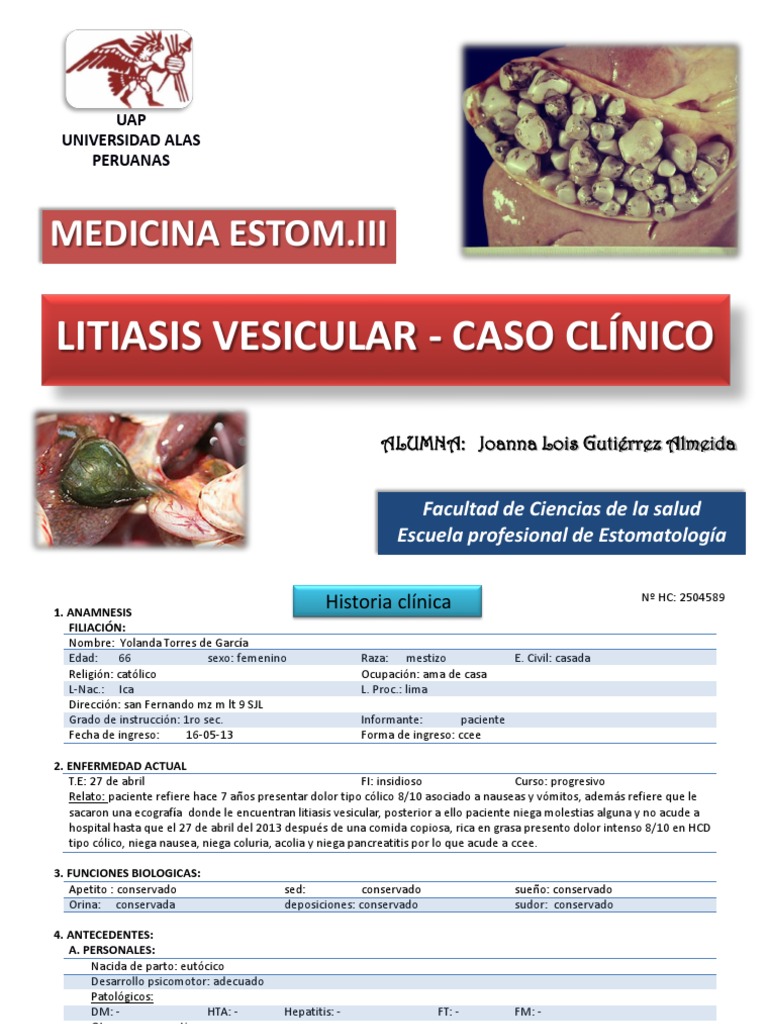 Caso Clínico - Litiasis Vesicular | PDF | Especialidades Medicas ...