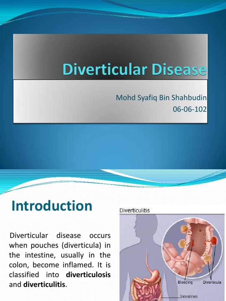 Diverticular Disease | Gastroenterology | Health Sciences