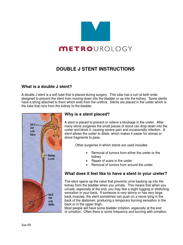 Double J Stent Instructions.pdf | Urology | Medical Specialties