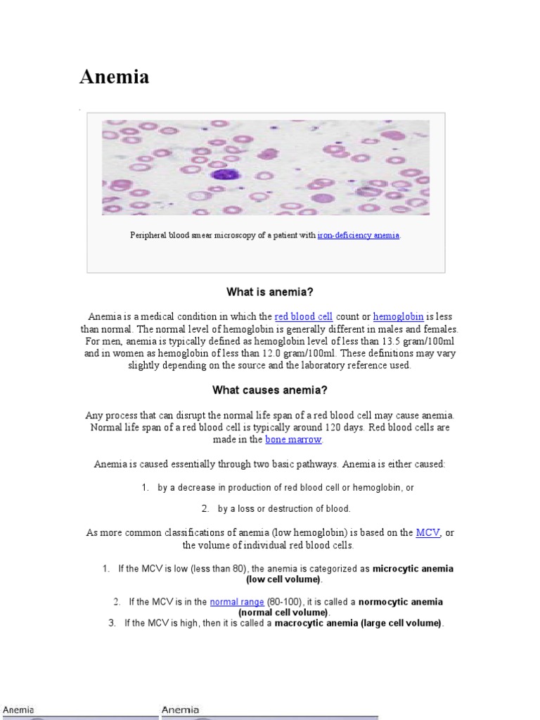 A Comprehensive Overview of Anemia: Classification, Causes, Symptoms ...