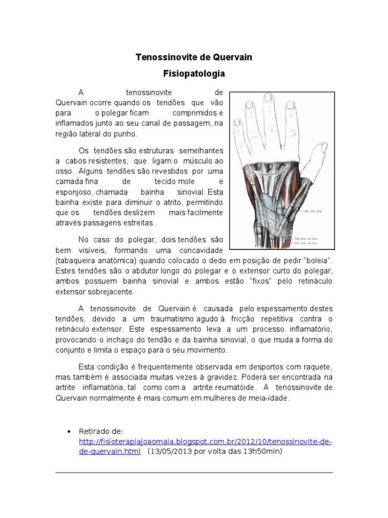 Fisiopatologia da Tenossinovite de Quervain | PDF | Tendão | Inflamação