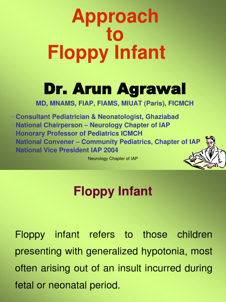 Approach to Floppy Infant | Weakness | Electromyography