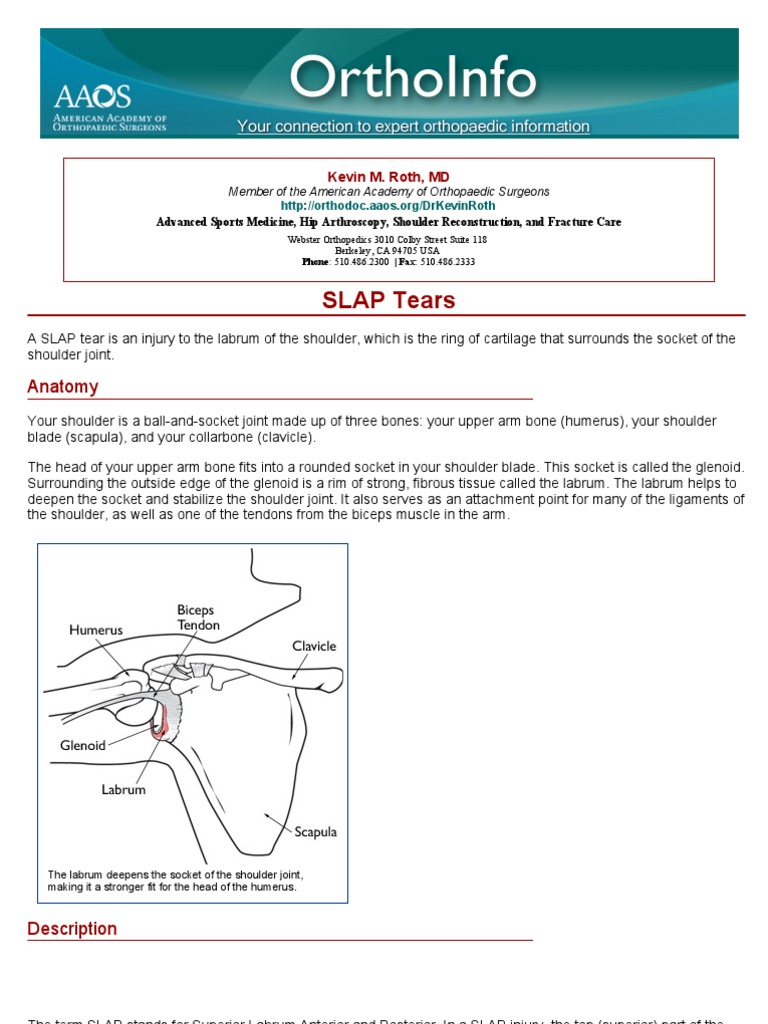 slap tears-orthoinfo - aaos | Shoulder | Arm