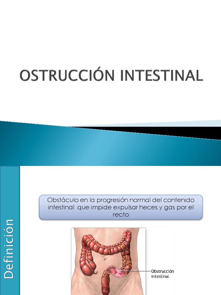 Obstruccion Intestinal | PDF | Gastroenterología | Medicina