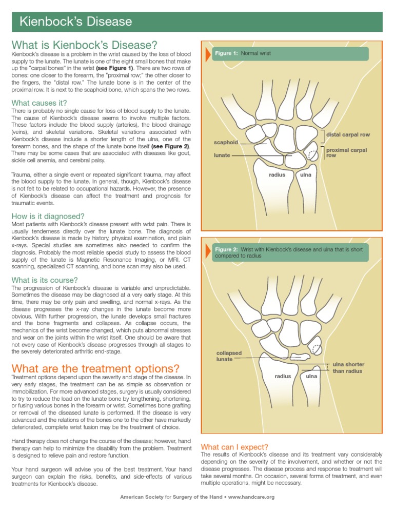 Kienbock Disease | PDF | Self-Improvement