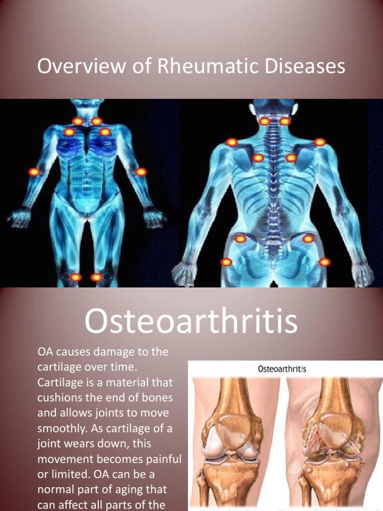 Rheumatology Diseases Pdf