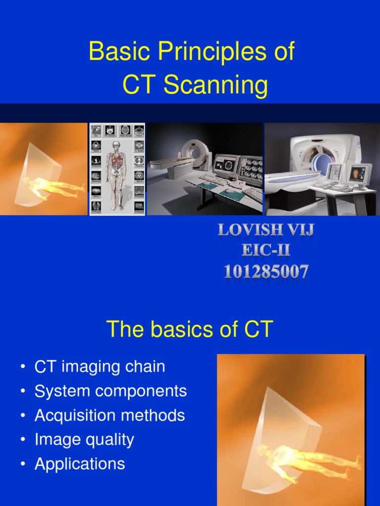 Basics - of - CT Scan (Lovish Vij Eic 2 101285007) | PDF | Optical ...