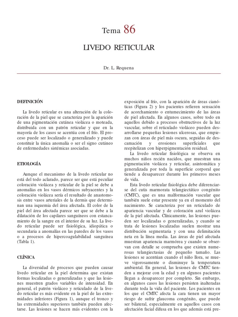 Livedo Reticularis | PDF | Piel | Isquemia