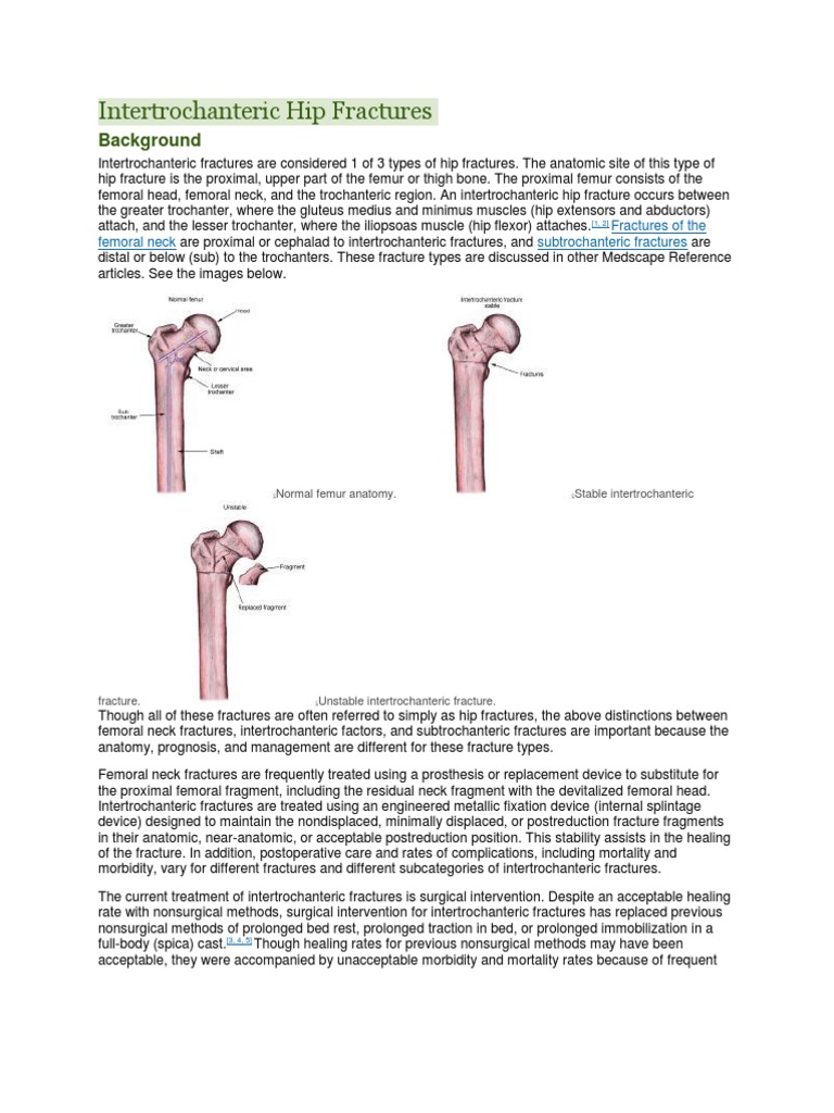 Intertrochanteric Fracture | Surgery | Hip