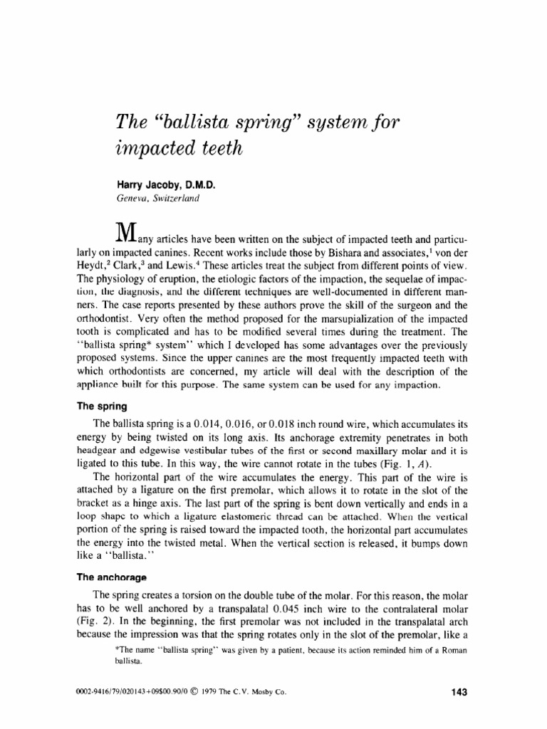 The "Ballista Spring" System For Impacted Teeth: Genevu. Switzerland ...