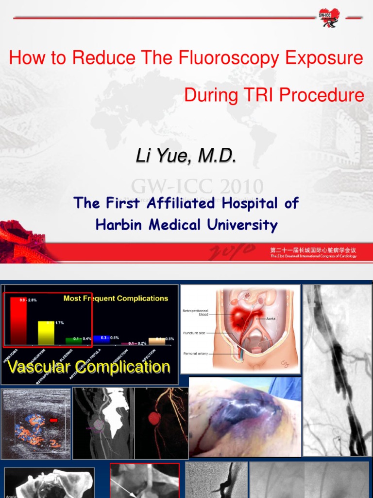 How To Reduce The Fluoroscopy Exposure During TRI Procedure: Li Yue, M ...