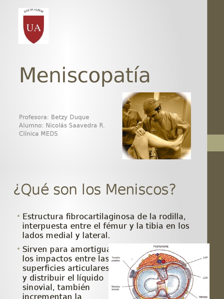 Meniscopatia | Rodilla | Articulaciones