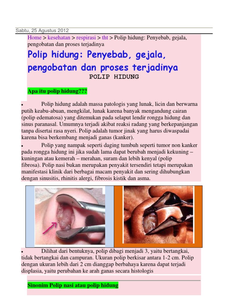 GEJALA DAN PENYEBAB POLIP HIDUNG | PDF