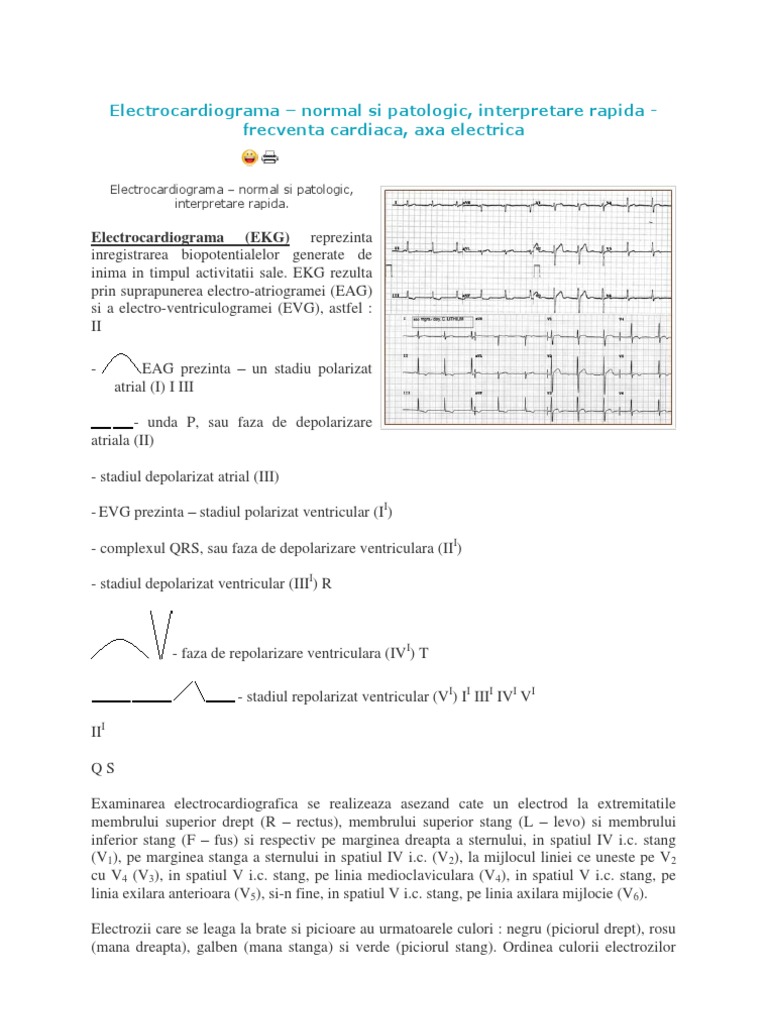 Electrocardiograma Interpretare | PDF