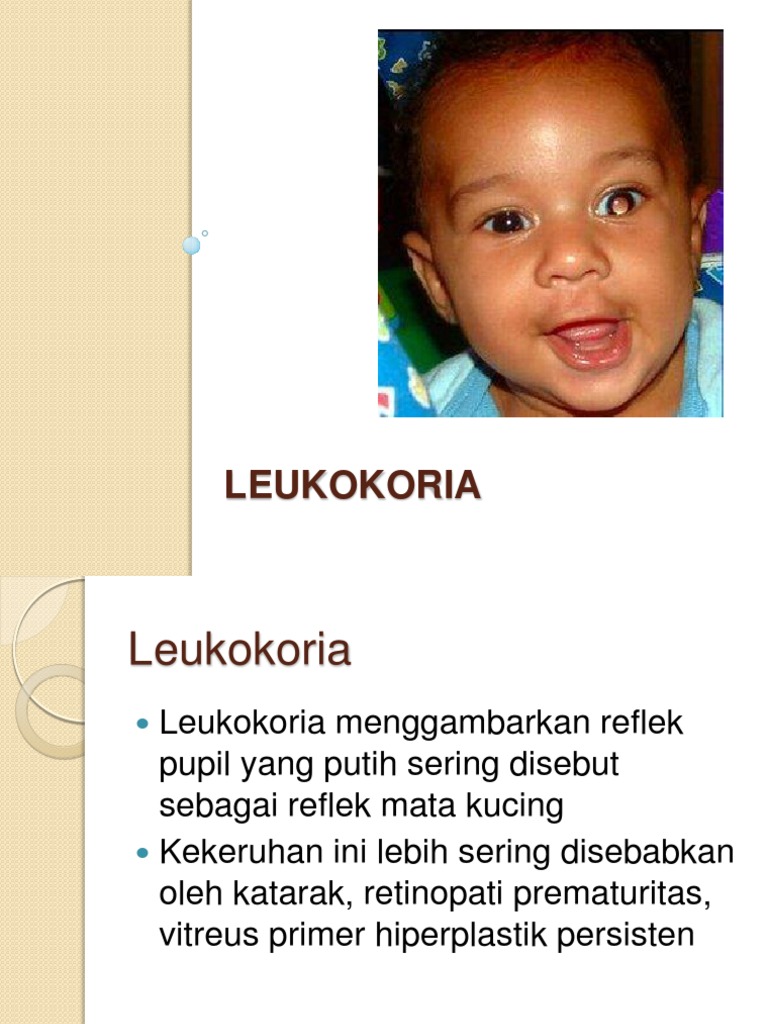 Leukocoria | PDF | Sains & Matematika