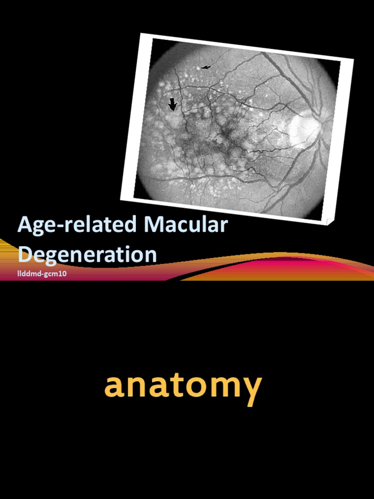Age Related Macular Degeneration Presentation 1 | Visual System ...
