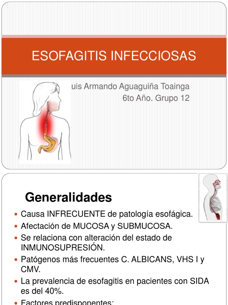 Esofagitis Infecciosas | PDF | Candidiasis | Especialidades Medicas